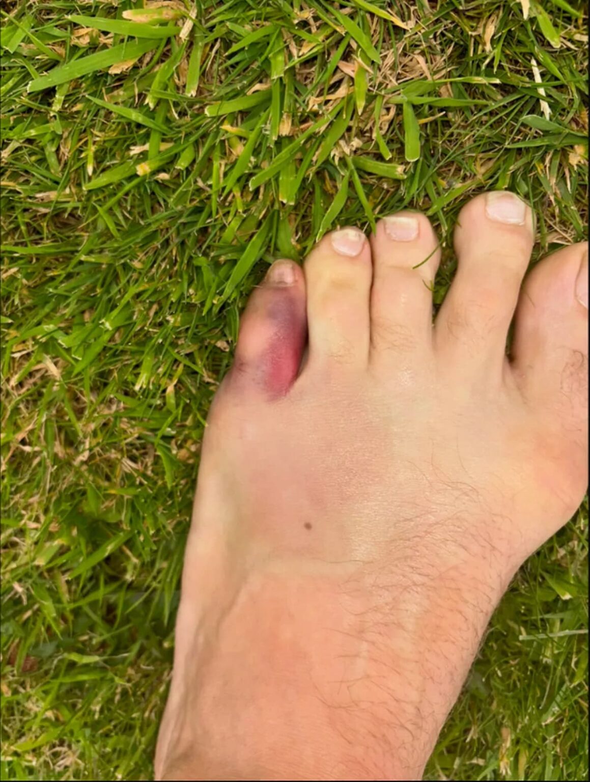 Conor McGregor posts injured toe photo, now deleted, that forced him ...