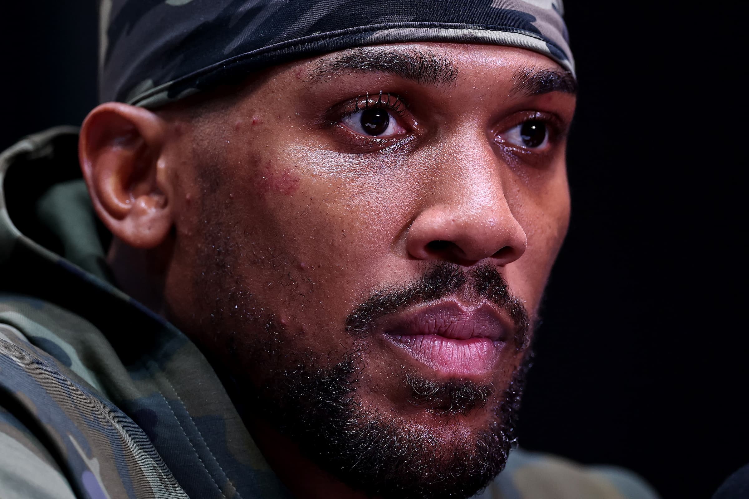 Anthony Joshua hospitalized after deadly car crash in Nigeria - FIGHTMAG
